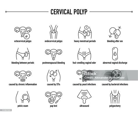 Symptômes Du Polype Cervical Icônes De Vecteur De Diagnostic Et De