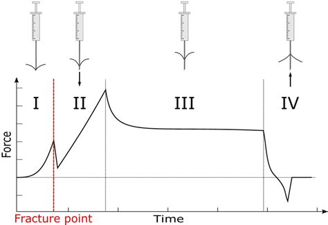 Needle Insertion Into Soft Tissues Divided Into Four Phases I