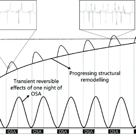 Dynamic Arrhythmia Substrate In Obstructive Sleep Apnea Dynamic Download Scientific Diagram