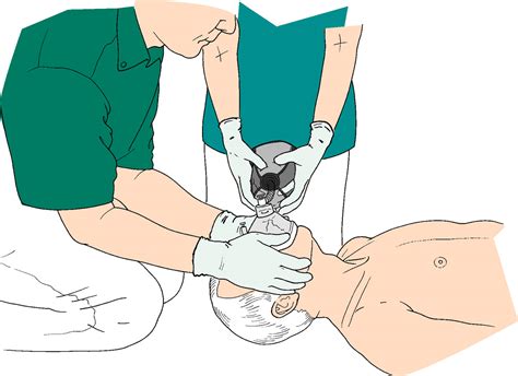 MANAGEMENT OF BREATHING