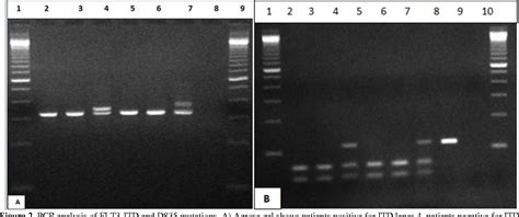 Figure 2 From Flt3 Internal Tandem Duplication And D835 Mutations In Patients With Acute