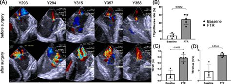 A Montage Of Echo Images Before And After Placement Of The Chordal