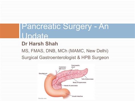 Tokyo Guidelines Mangement Of Acute Cholecystitis And Acute