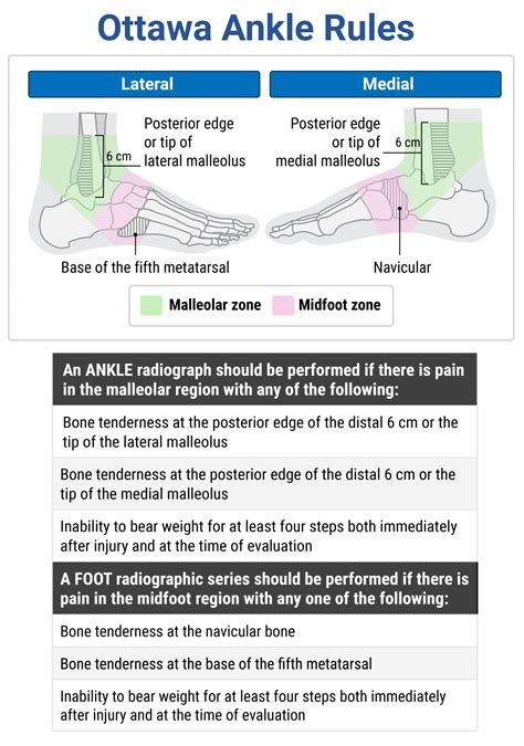 Rapid Review Ottawa Ankle Rules