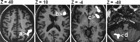 Neural Correlates Of Auditoryvisual Stimulus Onset Asynchrony Detection Journal Of Neuroscience
