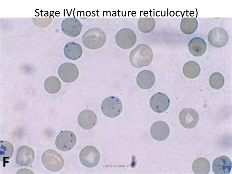 Reticulocyte Count Pptx