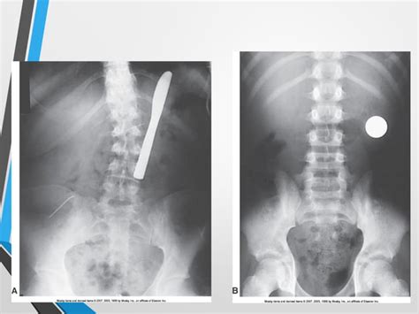 Trauma Radiography Medical Imaging Studyppt