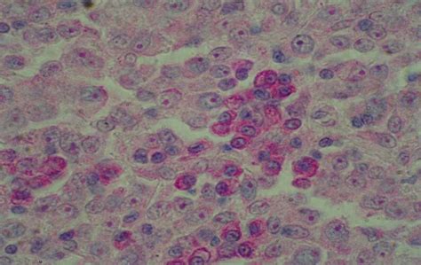 Plasma Citrate Infiltration Of Tumor Stroma Tissue Of Transmissible Download Scientific