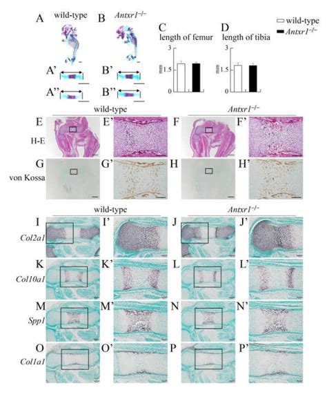 Antxr1 Which Is A Target Of Runx2 Regulates Chondrocyte Proliferation