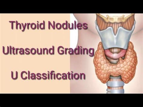 Thyroid Nodules Classification Benign Indeterminate And Malignant Nodules Dr Arshad Nadeem Awan