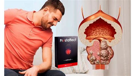 តើអ្វីទៅជា Prostaffect Youtube