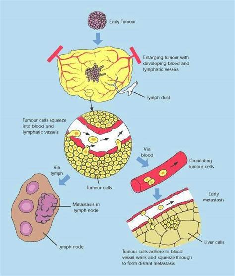 Avastin Bevacizumab Angiogenesis Inhibitor And Cancer Therapy