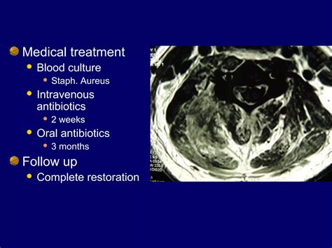 Spinal Epidural And Subdural Intramedullar Abscesses Ppt