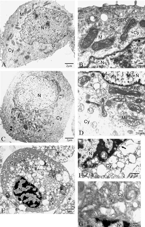 Nitroxide Tempo A Small Molecule Induces Apoptosis In Prostate