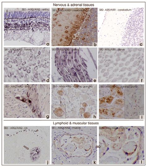 Immunodetection Of Prp D In Various Tissues Prp D Accumulation Was