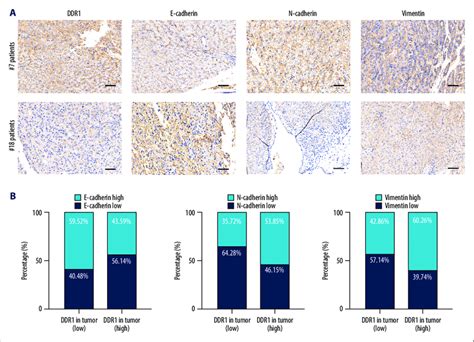 The Correlation Between Ddr1 And Emt Related Protein A Download Scientific Diagram