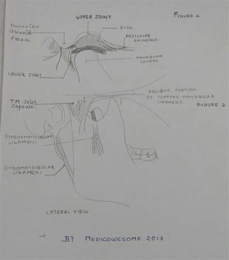 Temporomandibular Joint Diagram
