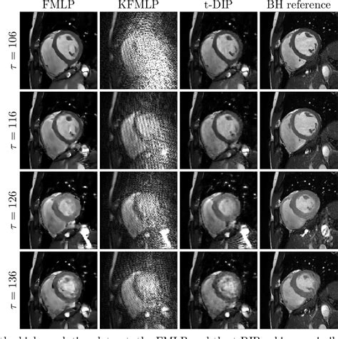 Figure 1 From Implicit Neural Networks With Fourier Feature Inputs For Free Breathing Cardiac
