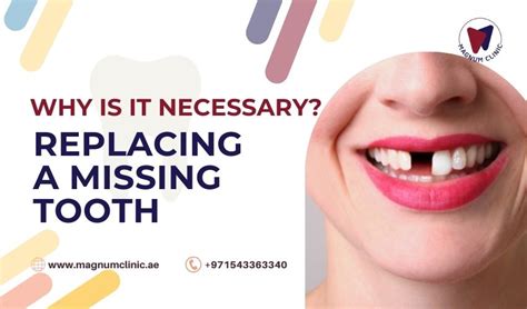 Replacing A Missing Tooth 5 Reasons Why Is It Necessary