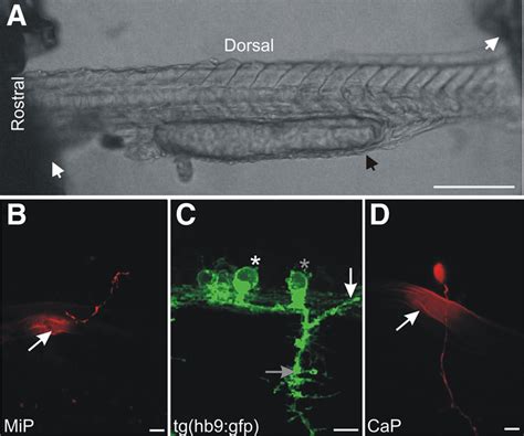Reliable Identification Of Primary Motor Neuron Pmn Subtypes Allows Download Scientific Reliable Identification Of Primary Motor Neuron Pmn Subtypes Allows Download Scientific