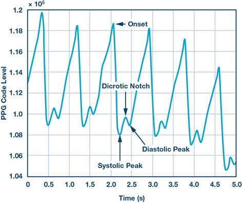 Ppg Heart Rate Algorithm At Dawn Wilkerson Blog