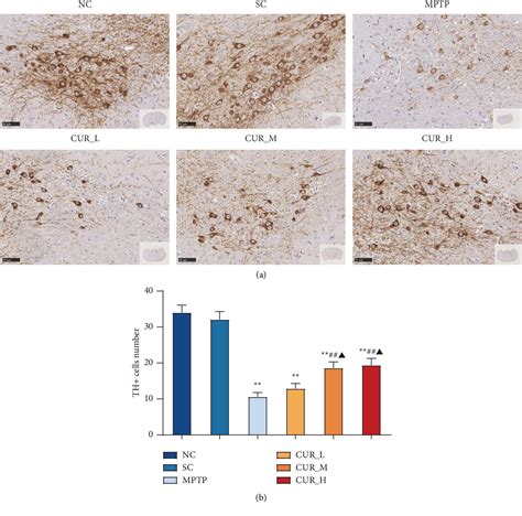 Figure 2 From Curcumin Regulates Gut Microbiota And Exerts A Neuroprotective Effect In The Mptp