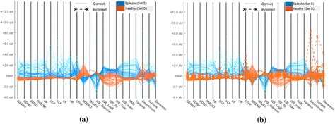 Detection Of Epileptic Seizure Using Varying Feature Set And Download Scientific Diagram