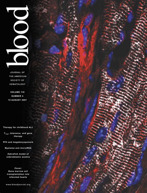 Trisomy 13 Is Strongly Associated With Aml1runx1 Mutations And
