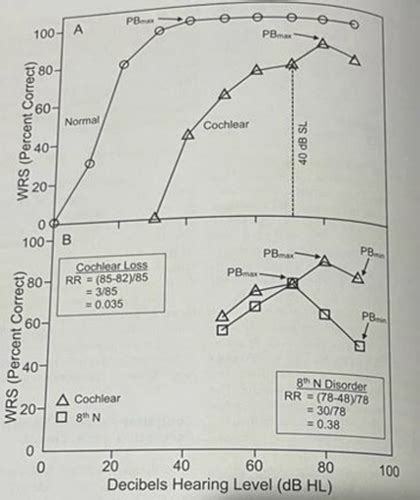 Speech Audiometry Flashcards Quizlet