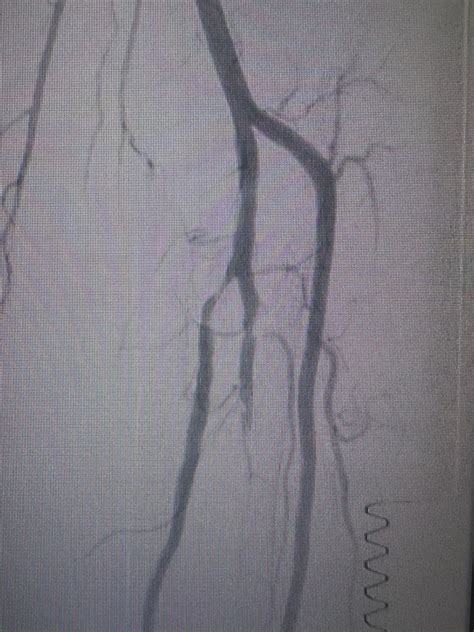 Sridhar Sampath Kumar On Linkedin Hawkone Cli Betterluckythangood