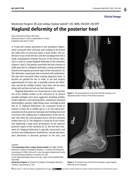 Haglund Deformity Of The Posterior Heel Pdf Foot Musculoskeletal