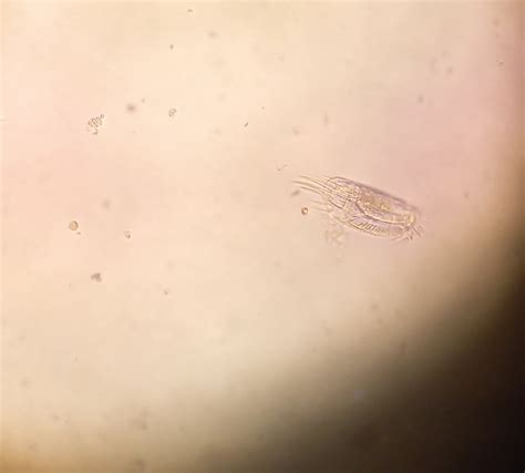 Is The Picture In The Attachment Of Saccostrea Oyster Larvae Or Some