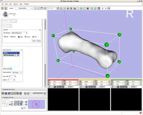 2008 Winter Project Week UnstructuredGrids NAMIC Wiki