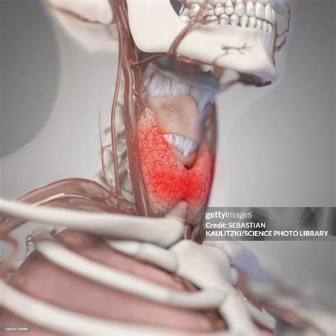 Larynx And Thyroid Illustration High Res Vector Graphic Getty Images