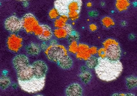 The Ultimate Guide To Preventing And Removing Mould In Your Home Electrodry Blogs