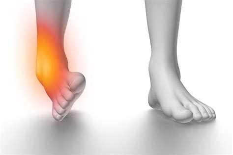 Have You Experienced A Twisted Ankle ActiveSTL Chiropractic And