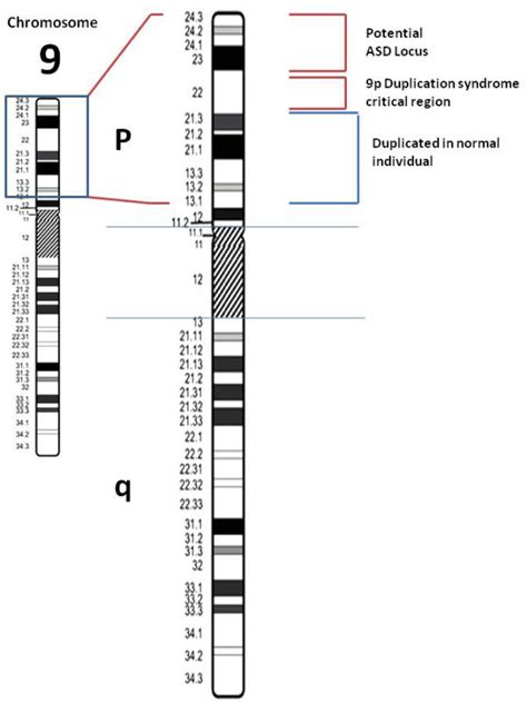 Ideogram Showing The Duplicated Area Chromosome 9 Ideogram