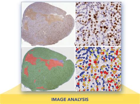 Histopathology Tissue Processing Services Seqmatic