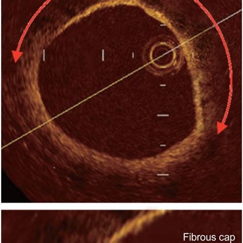 A Time Domain Optical Coherence Tomography System B Download Scientific Diagram