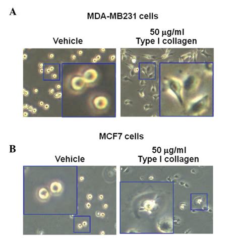 Morphology Of Human Breast Cancer Cells In The Hdf Conditioned Culture Download Scientific