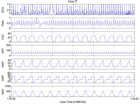 Case 27 Waveform Plots 60 Second Plots