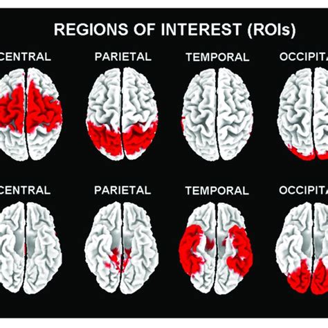 Pdf Classification Of Healthy Subjects And Alzheimers Disease