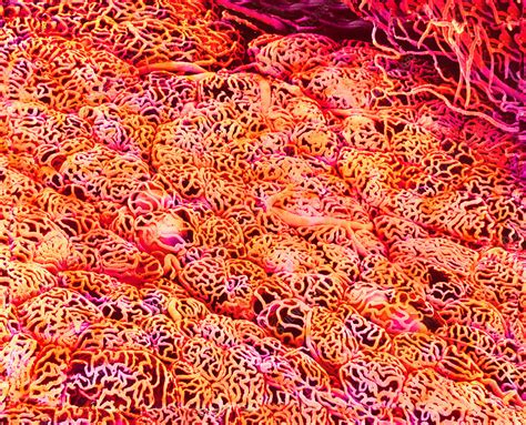 Thyroid Capillaries Sem Stock Image P2120038 Science Photo Library