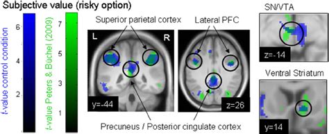 Regions In Which Neural Activity Showed A Positive Correlation With