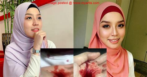 Penyebab Keluar Darah Saat Berhubungan Tapi Tidak Sakit Perumperindo Co Id