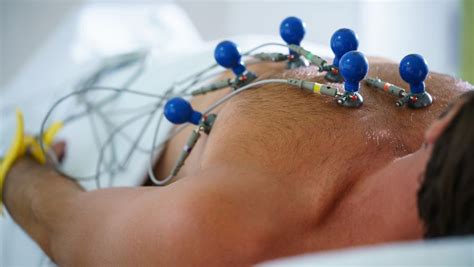 Sechenov University Taught A Neural Network To Find Heart Pathologies Using Ecg