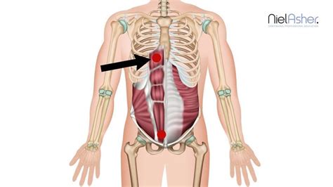 How To Find Trigger Points Rectus Abdominis In 2025 Trigger Points