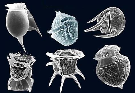Dinoflagellates Under Microscope Labeled