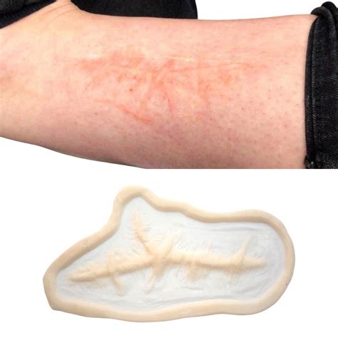 Prosthetic Keloid Scarprosthetic Lacerationwoundcutslatex Freemak