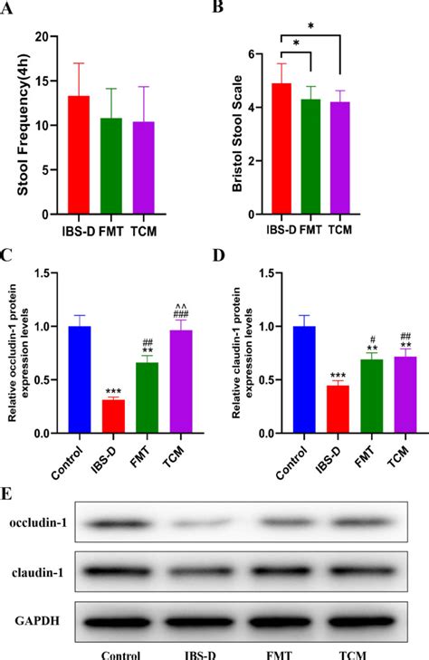 FMT And TCM To Treat Diarrhoeal Irritable Bowel Syndrome With Induced Spleen Deficiency Syndrome